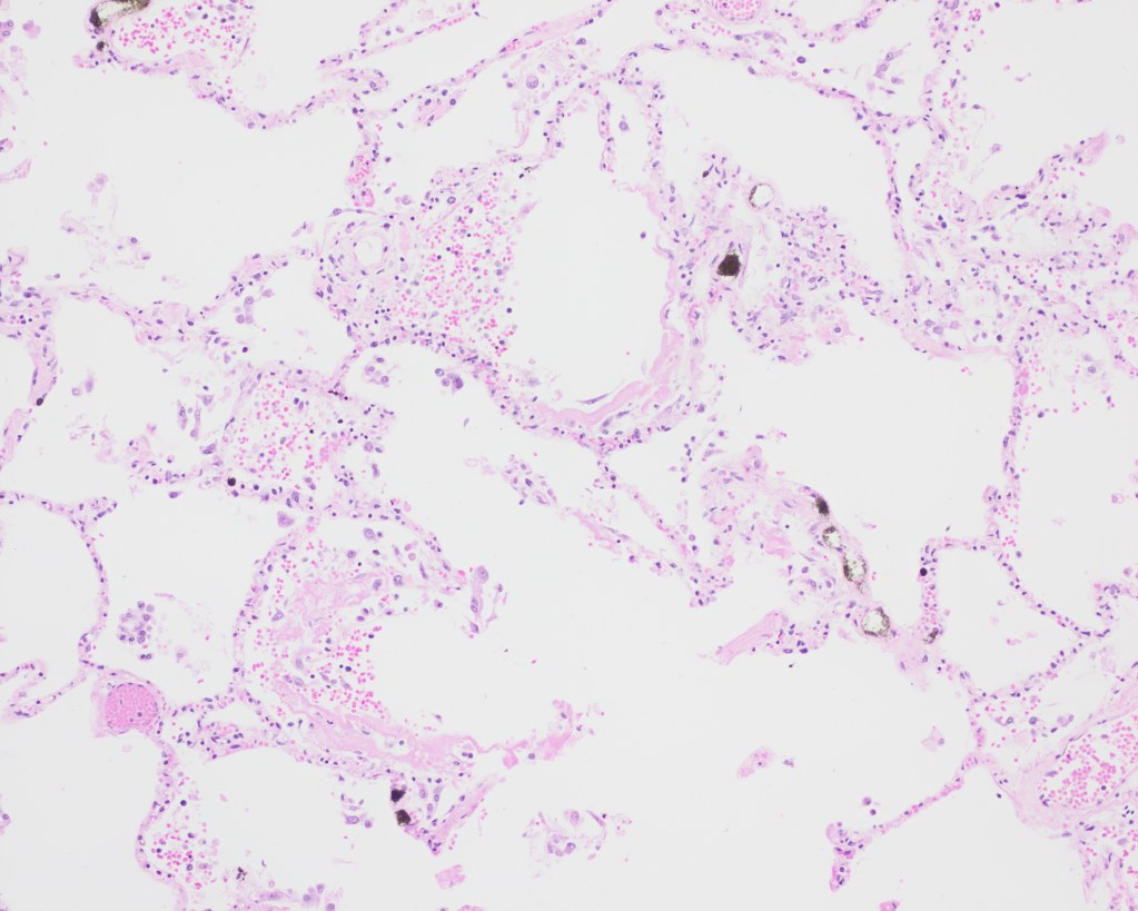 COVID-19 | The Autopsy Book