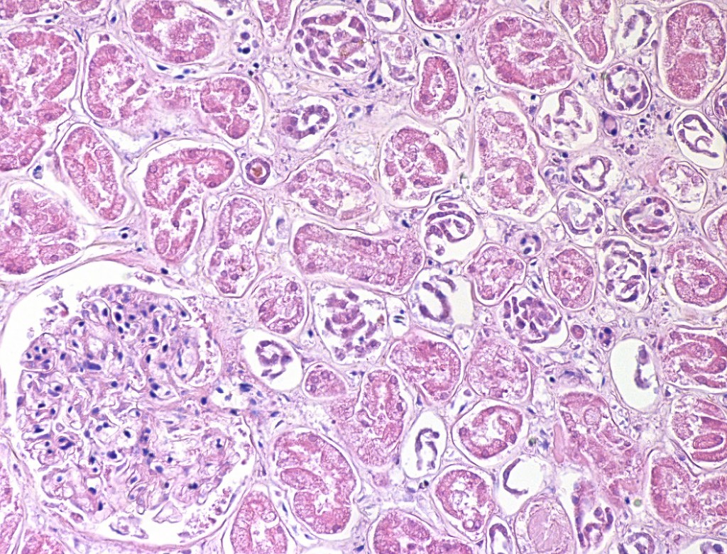 Autolysis/Postmortem Histology | The Autopsy Book