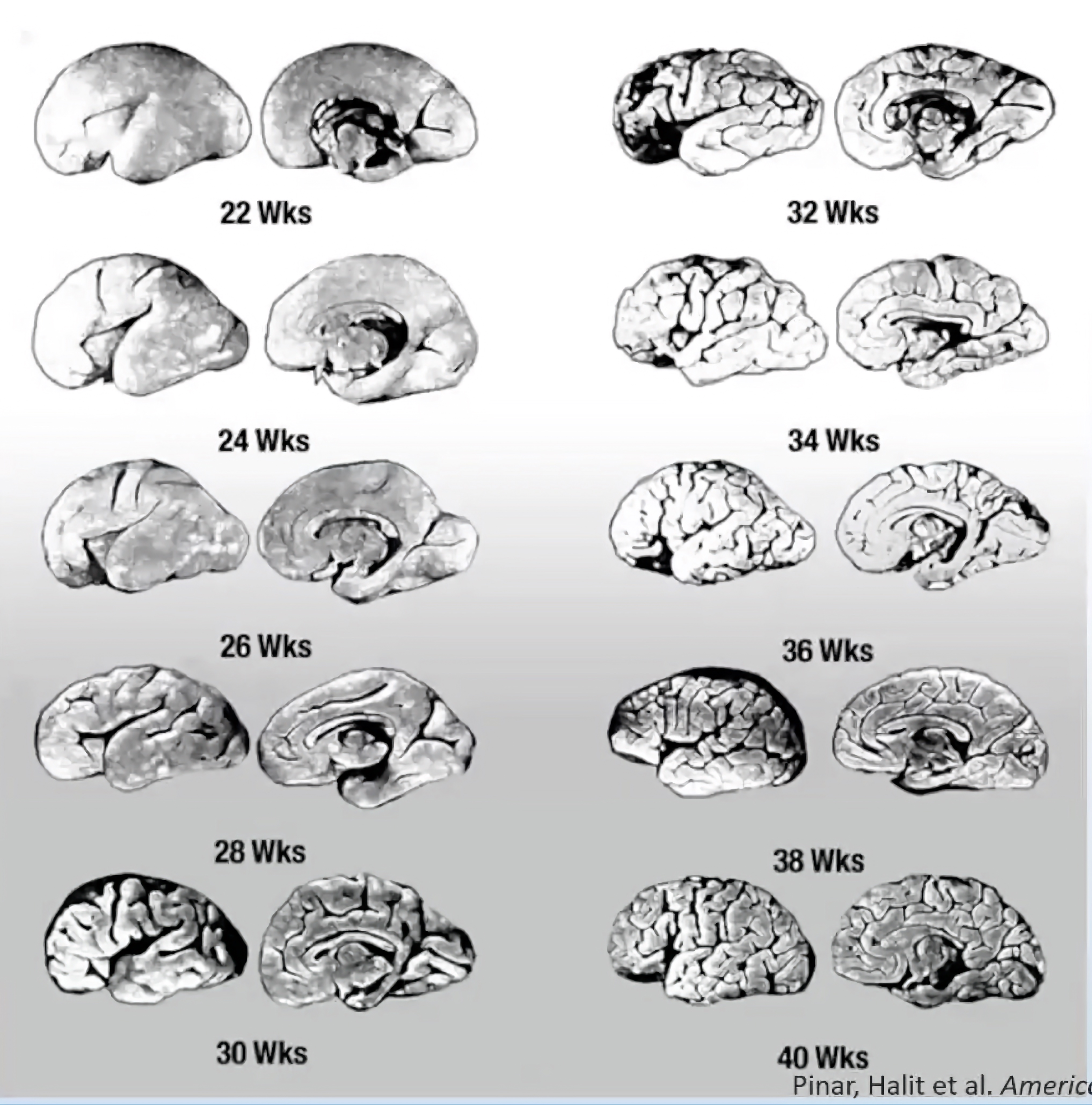 Fetal Autopsy: Determining Gestational Age | The Autopsy Book